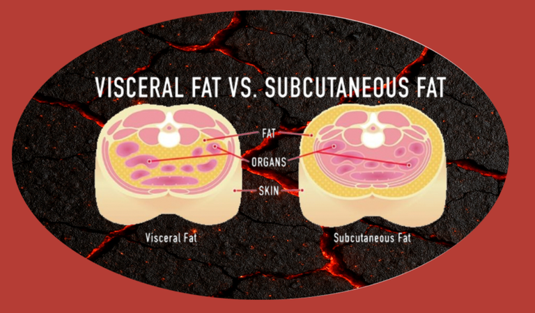 Subcutaneous Fat vs. Visceral Fat: What’s the Difference and Why It Ma ...
